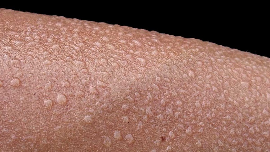 Artificial Skin Could Give Superhuman Senses