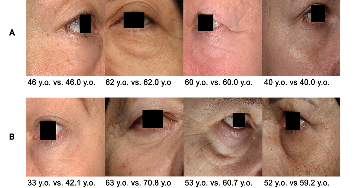 This AI can Accurately Predict Your Age And Help You Look Younger