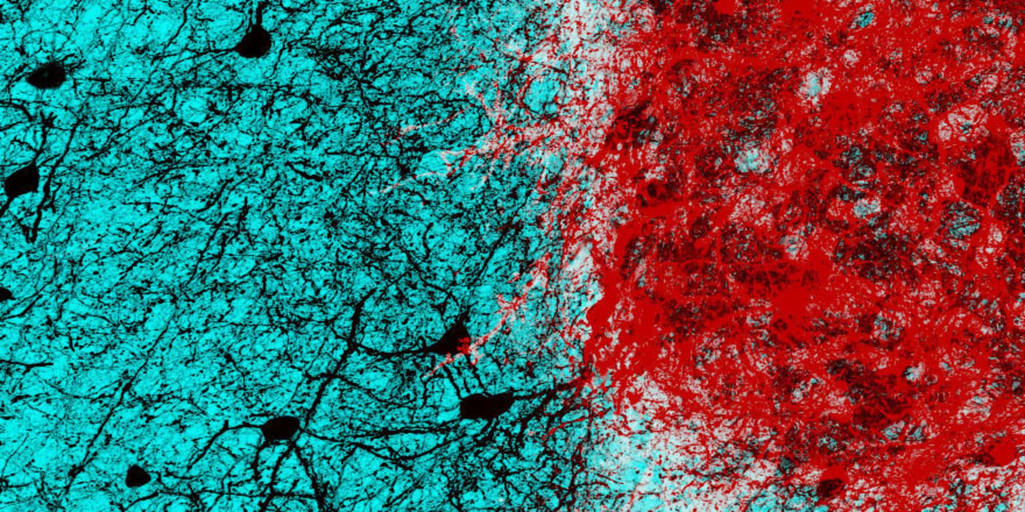 A New Era: Scientists Successfully Transplant Embryonic Neurons