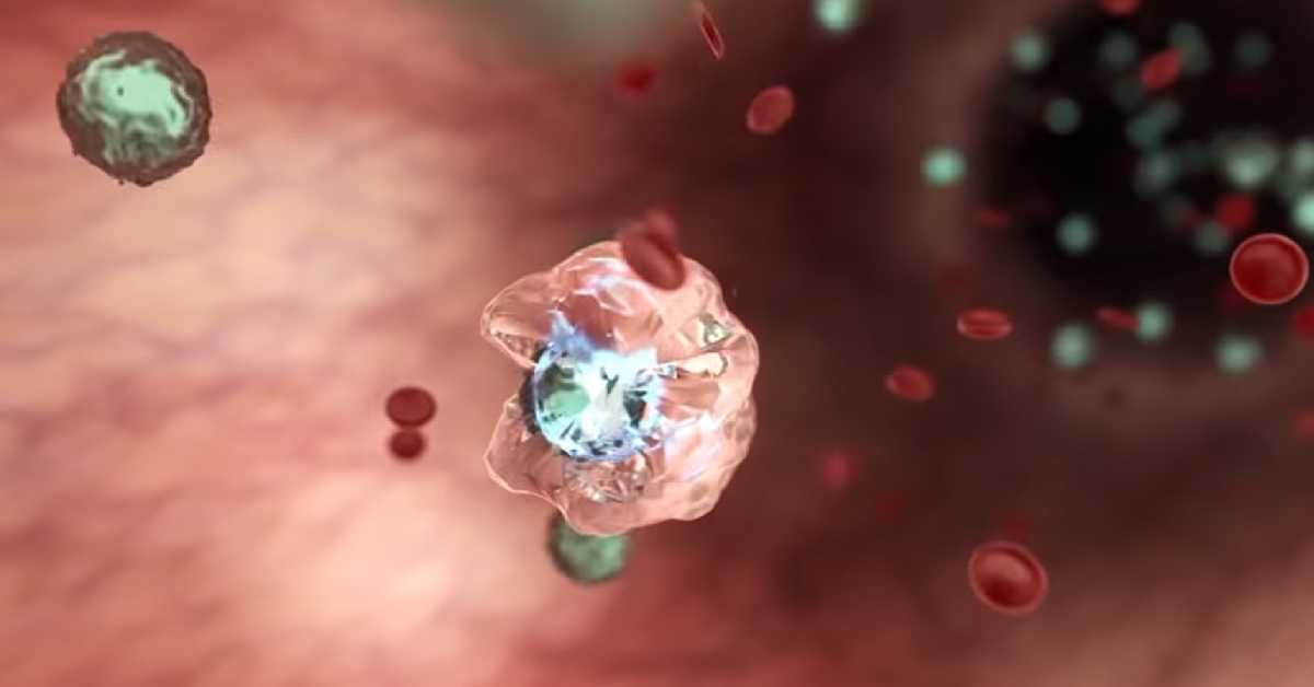First Human Clinical Trial of HIV Drug Gammora Offers Potential Cure
