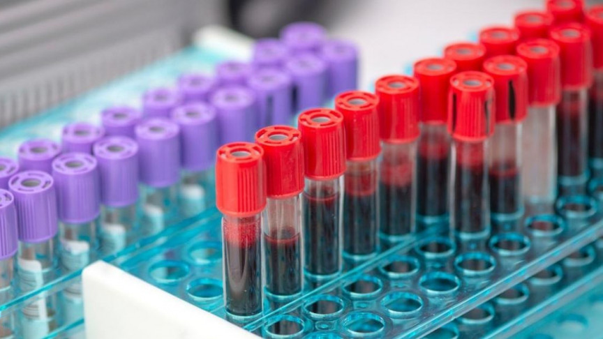 New Blood Test Detects Cancer 4 Years Ahead Of Symptoms new-blood-test-detects-cancer-4-years-ahead-of-symptoms
