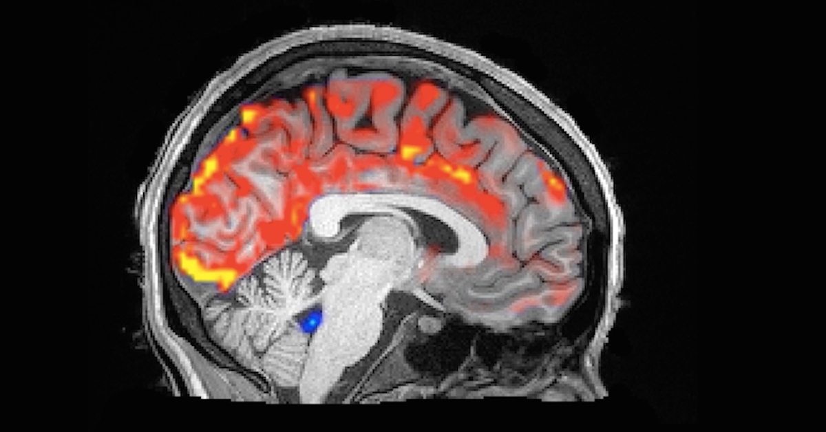 How Sleeping Washes Our Brains Clean of Unwanted Toxins