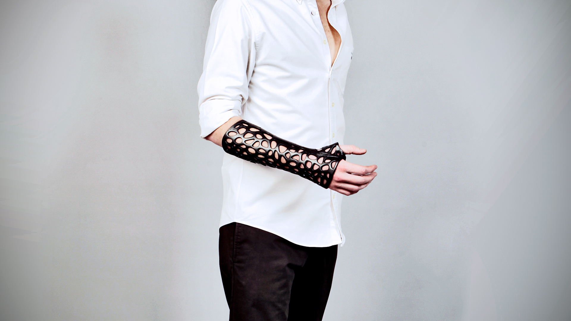 Custom-Made 3D Printed Cast Heals Bones 40% Faster