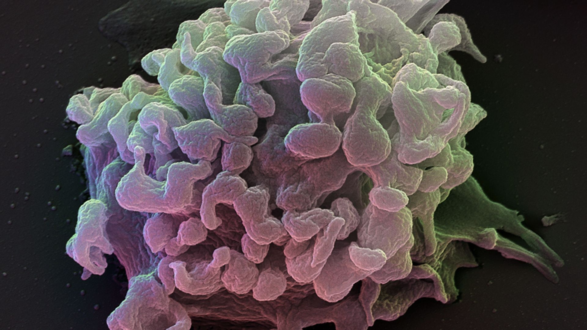 A new type of killer T-cell stops attacks on healthy tissue