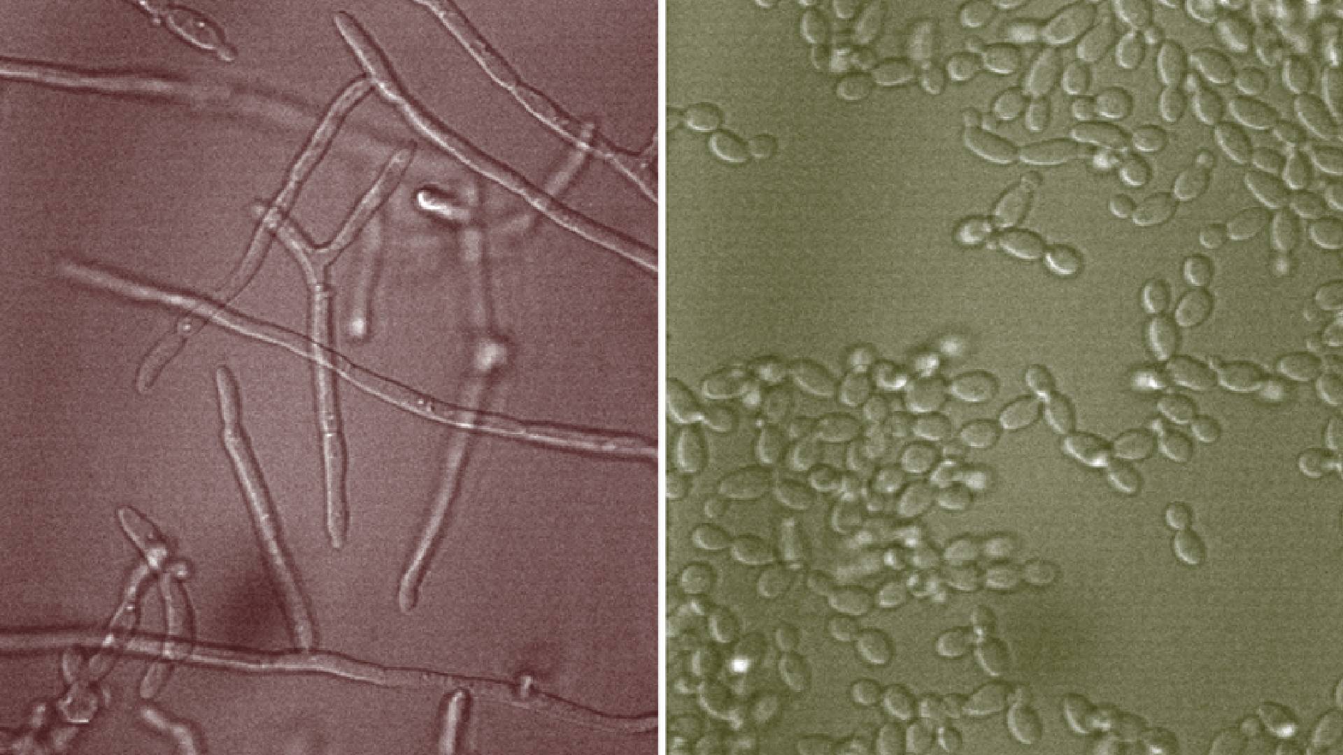 Molecules in mucus may be the key to thwarting fungal infection