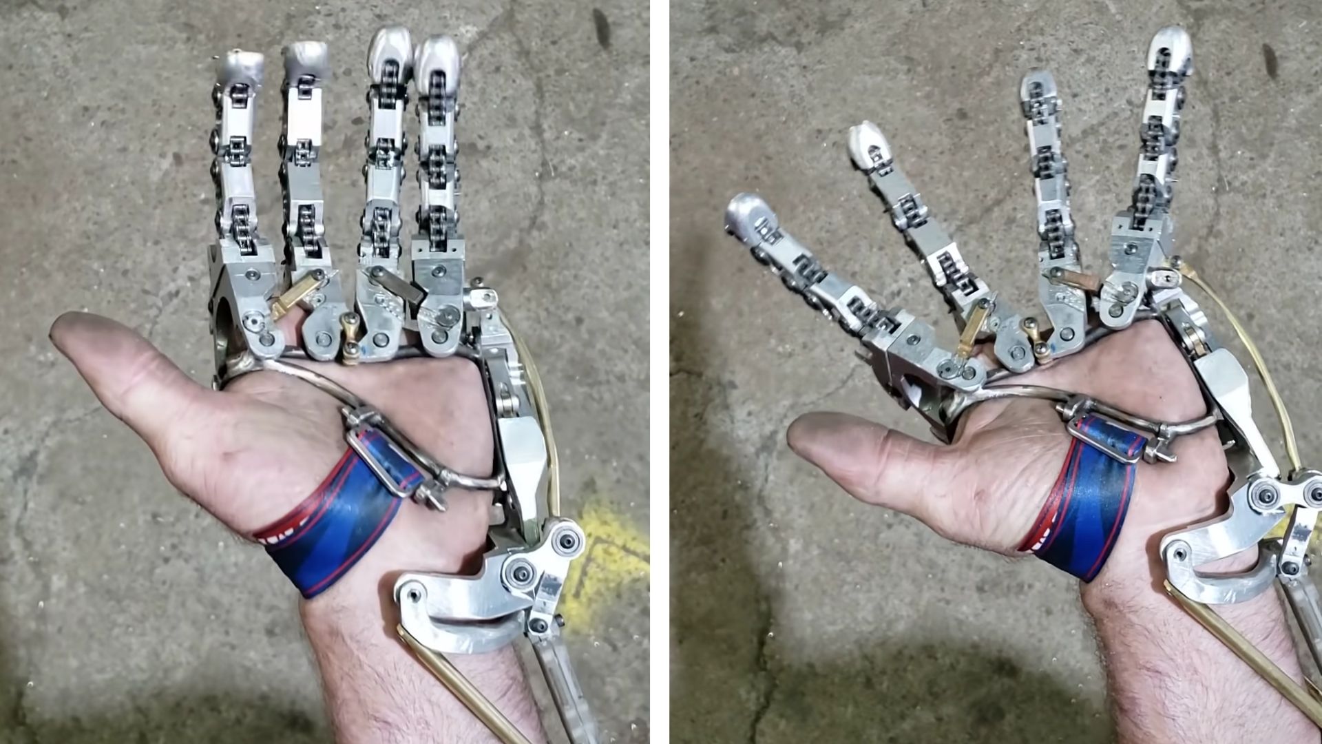 Not Satisfied With Digital Prosthetics, Man Invents Own Mechanical One