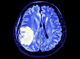 Direct Brain-to-Brain Communication is Now Possible