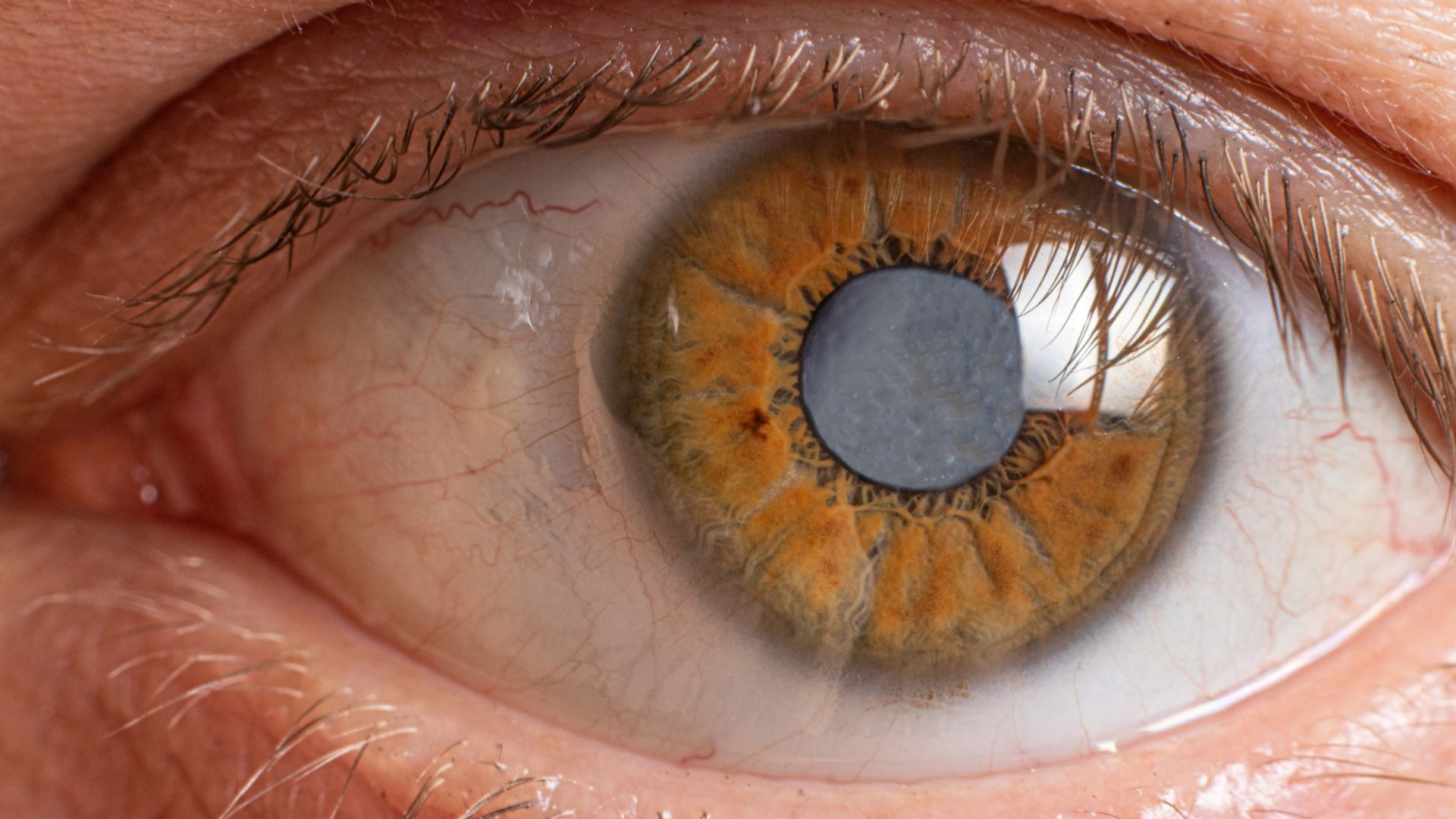 A new drug could solve the problem of cataracts, without surgery
