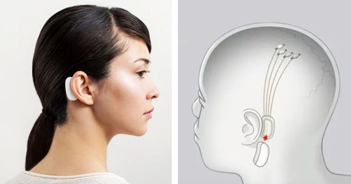 Neuralink Chip Will Be Able to Stream Music Into Your Brain