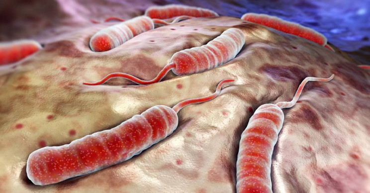 The Blue Death: Here's How the Horrific Blight of Cholera Got Its Name