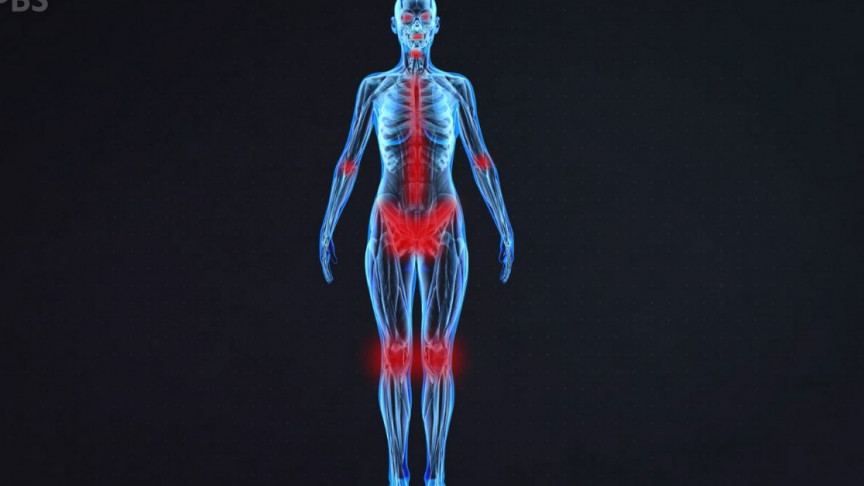 How Human Body Evolved Into A Sandbag With A Lot Of Weak Spots How Human Body Evolved Into A Sandbag With A Lot Of Weak Spots